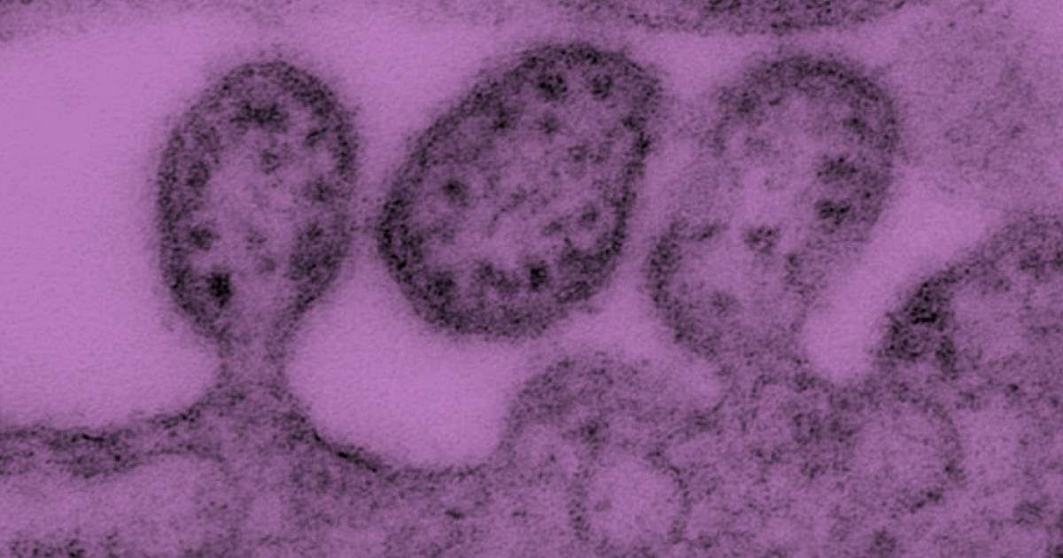 O ressurgimento do vírus sabiá : Revista Pesquisa Fapesp