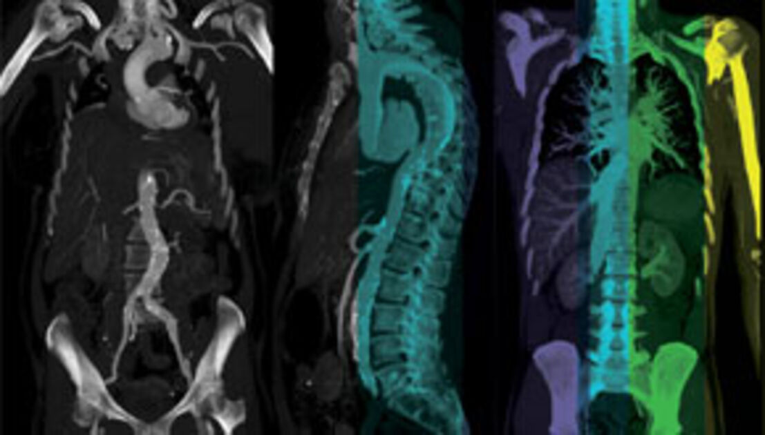 Digital Autopsy : Revista Pesquisa Fapesp