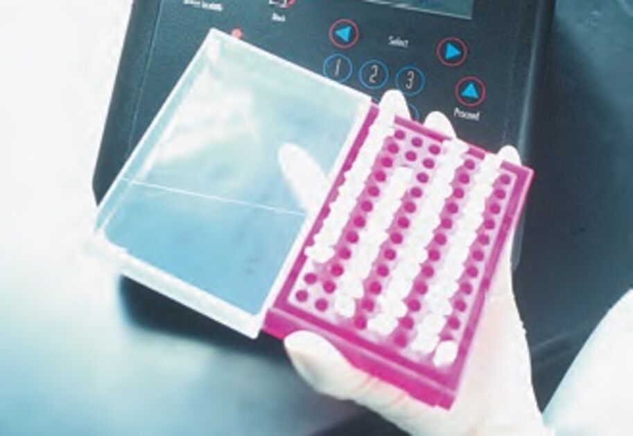 Fine sieve : Revista Pesquisa Fapesp