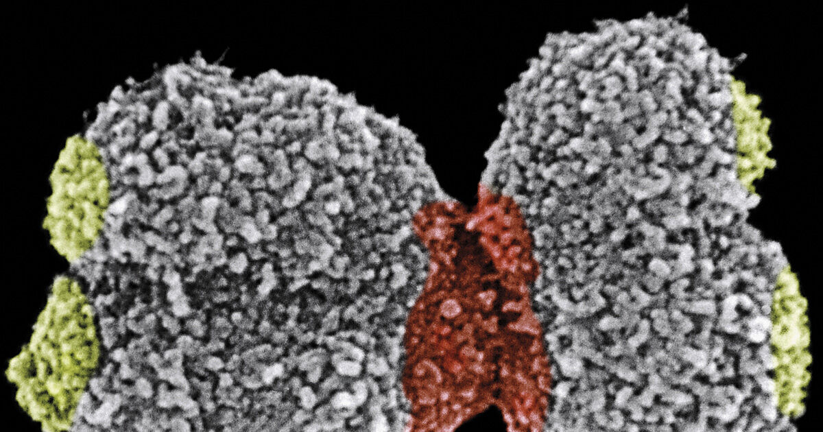 Accelerated DNA deterioration : Revista Pesquisa Fapesp