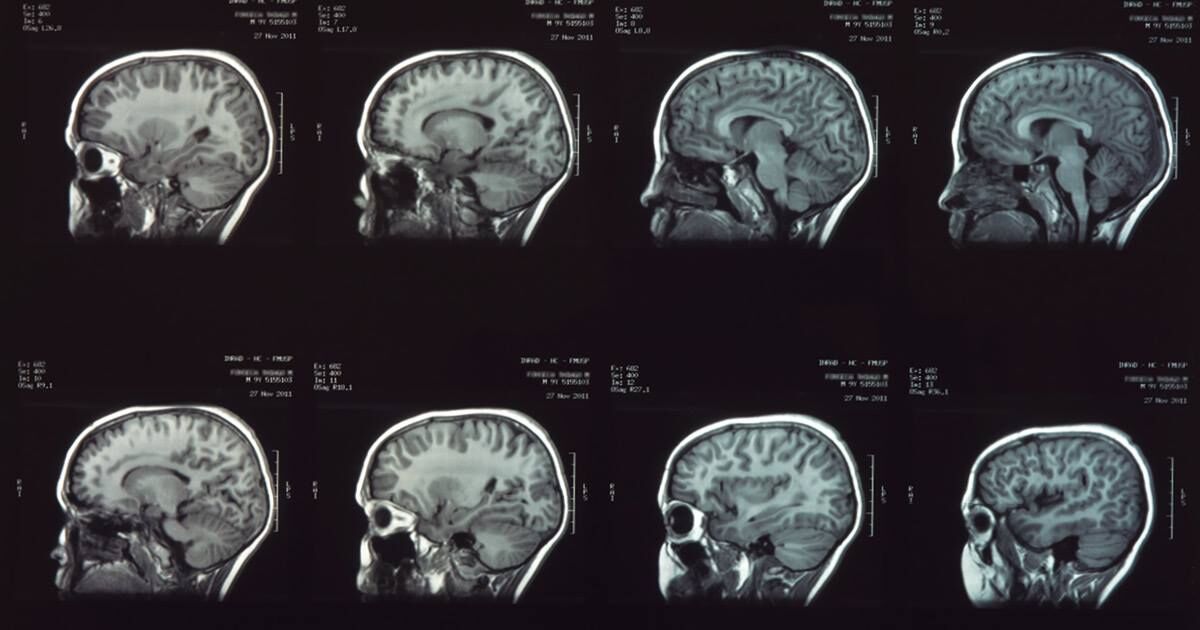 Study maps brain evolution over a lifetime : Revista Pesquisa Fapesp