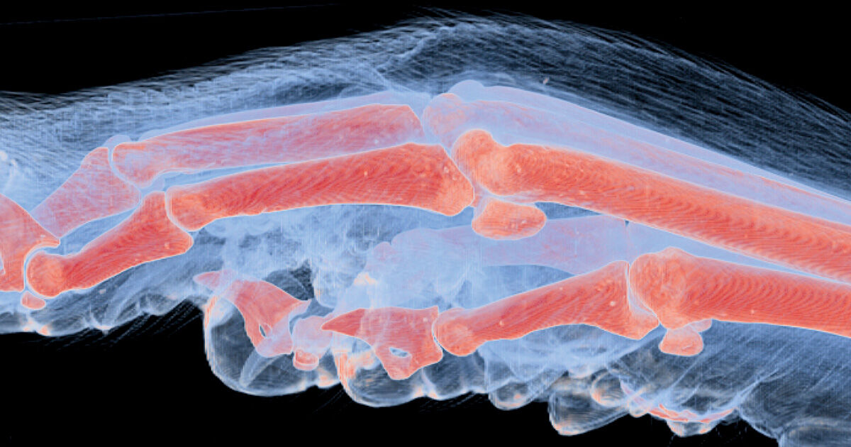 Infecção por vírus mayaro gera inchaço na pele, nos músculos e nas ...