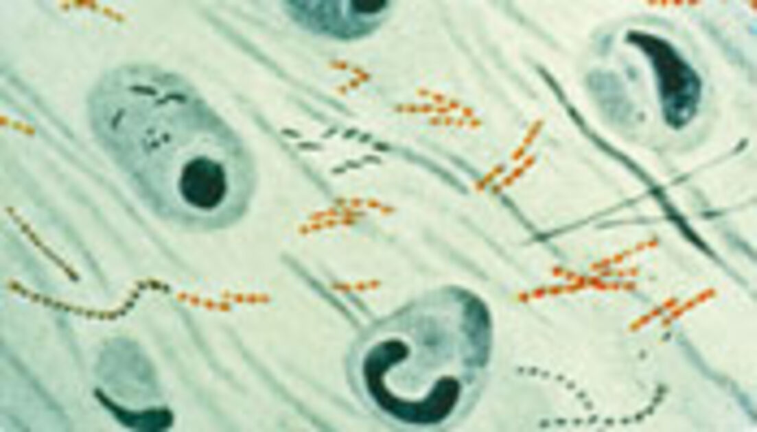 Por que a BCG às vezes falha : Revista Pesquisa Fapesp