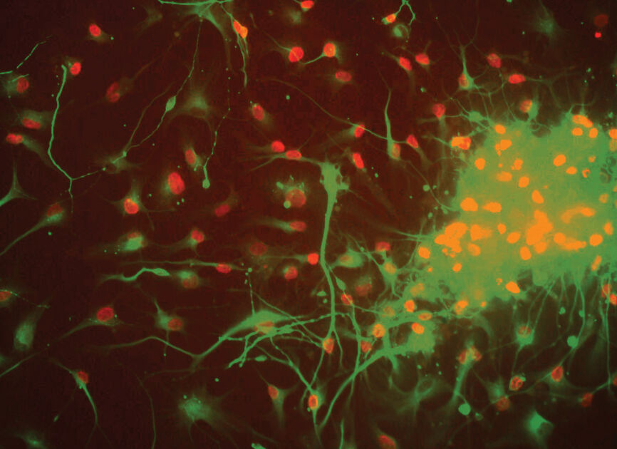 Diversity in neuronal DNA : Revista Pesquisa Fapesp