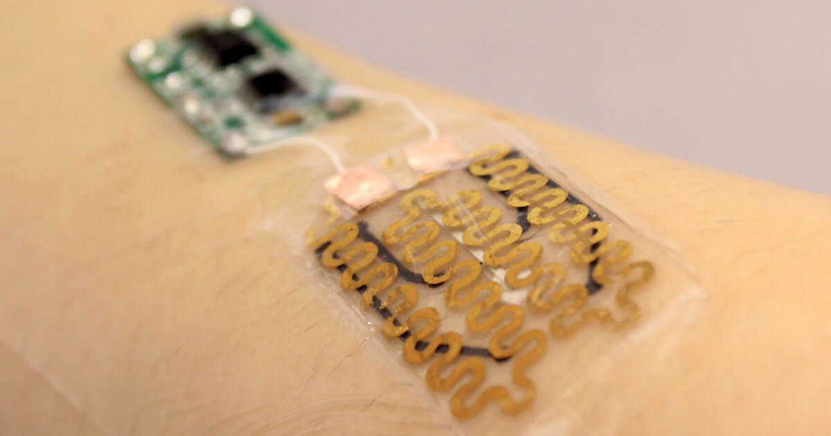 A high-tech dressing for chronic wounds : Revista Pesquisa Fapesp