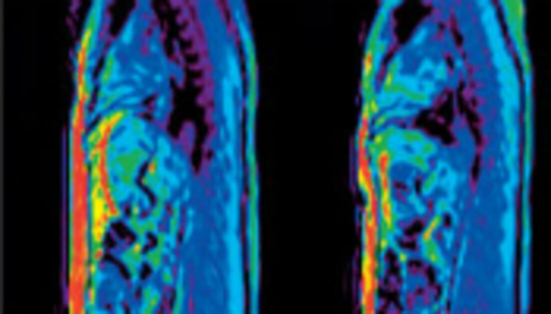 A more selective attack : Revista Pesquisa Fapesp