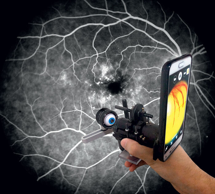 Eye on the smartphone : Revista Pesquisa Fapesp