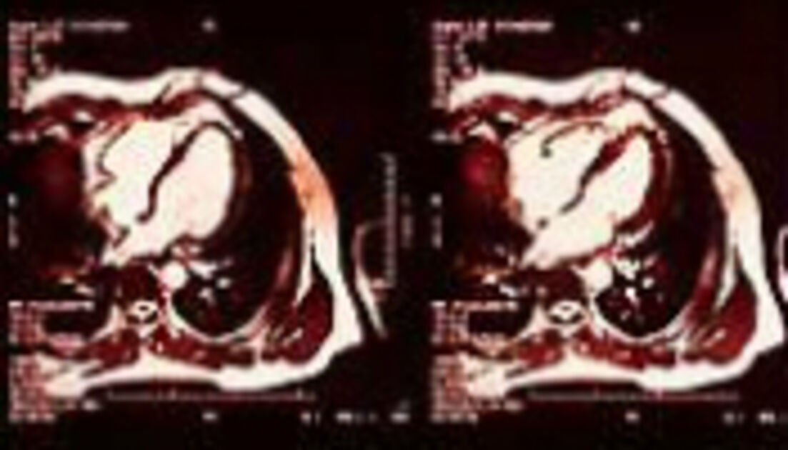 Corazón restaurado : Revista Pesquisa Fapesp