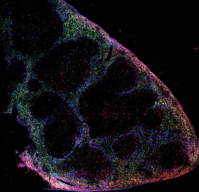 When our defenses destroy our brain : Revista Pesquisa Fapesp