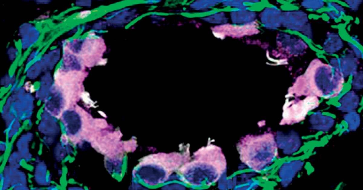 Coronavirus infects the ear : Revista Pesquisa Fapesp