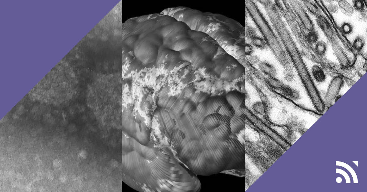 Influenza, proteômica, papers : Revista Pesquisa Fapesp