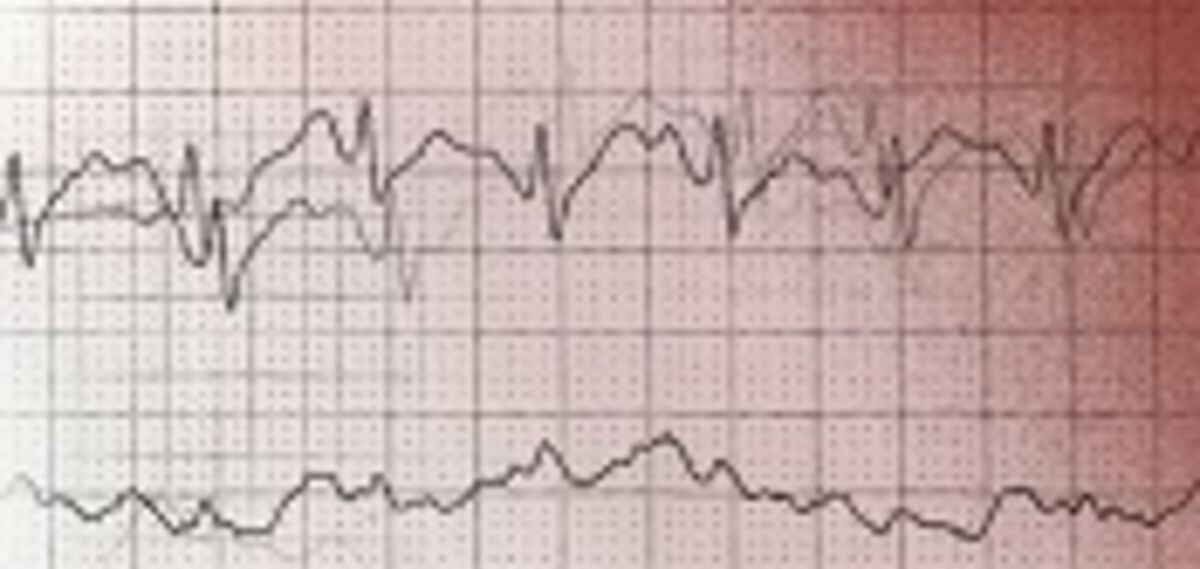 The channels of the heart : Revista Pesquisa Fapesp