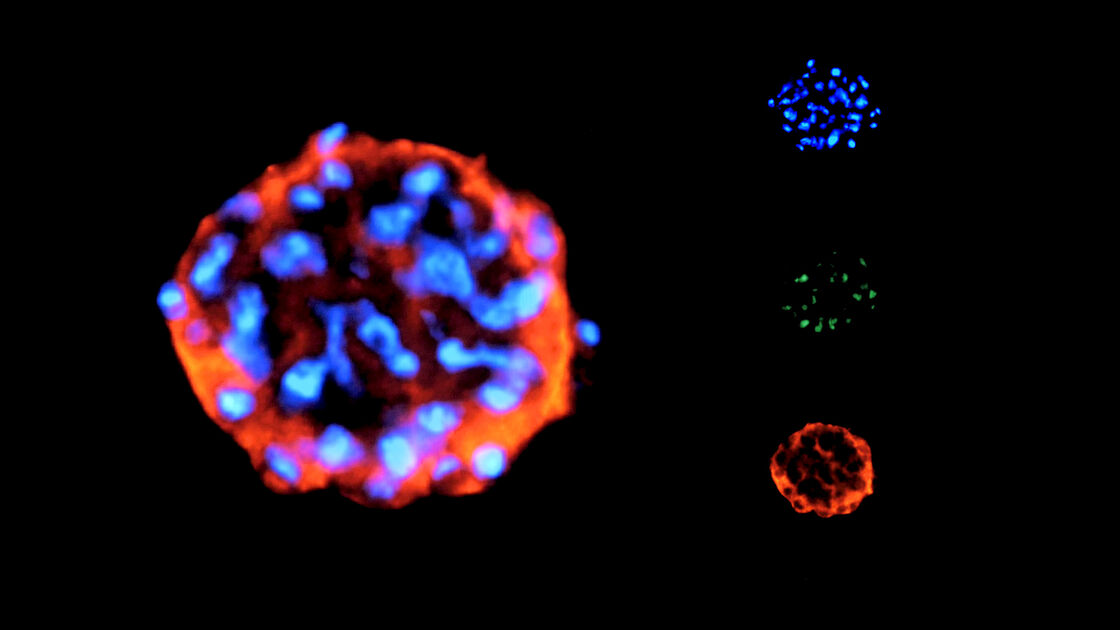 Suspended cell gardens : Revista Pesquisa Fapesp