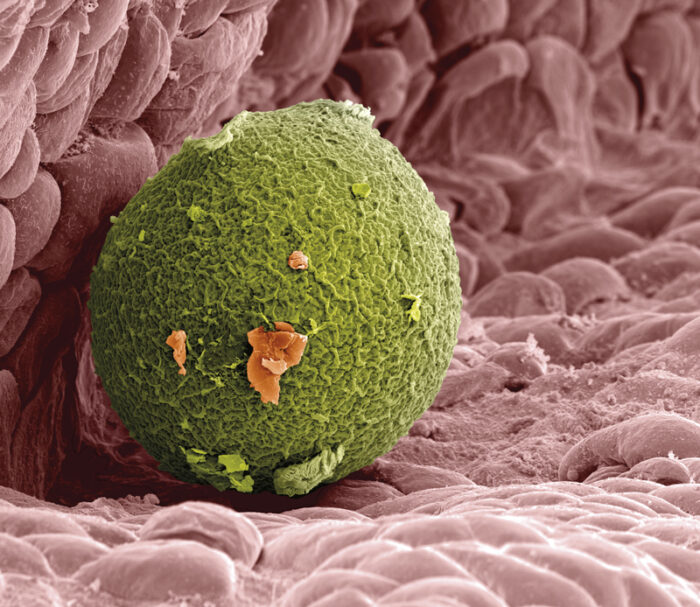 Estudo mapeia o percurso de óvulos importados para o Brasil : Revista ...